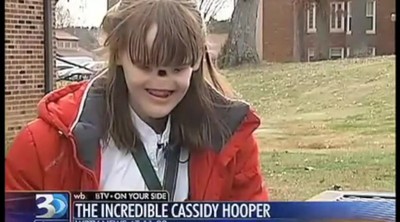 Girl Born With No Eyes or Nose Receives a Miracle