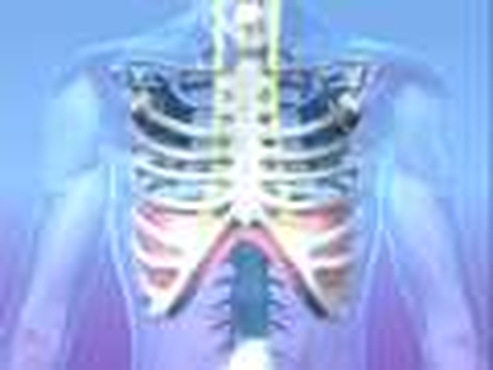 Synapse BioMedical Inc., NeuRX Diaphragm Pacing System | GodTube.com
